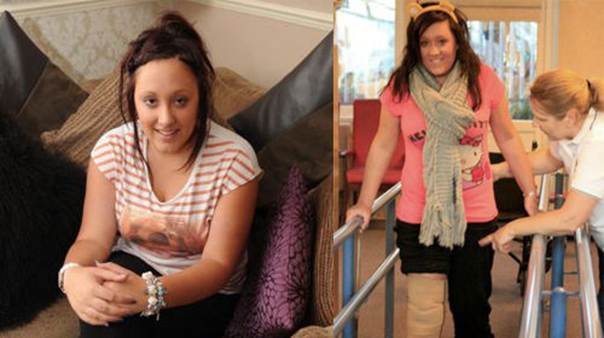 Chanel Carter và quyết định cưa chân vì ballet - Tuổi Trẻ Online