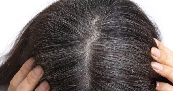 Tóc bạc do đâu, có thể ngăn ngừa được không? - Tuổi Trẻ Online